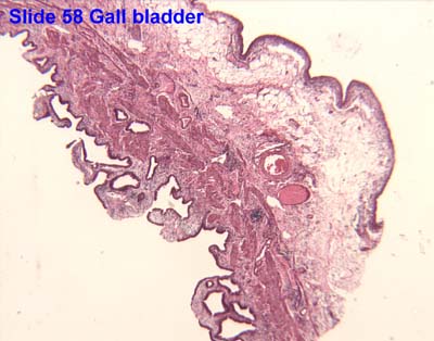 Gall Bladder Slide